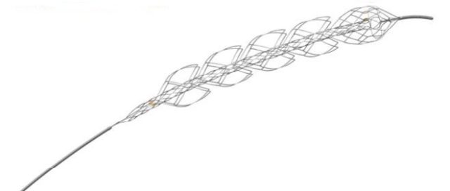 First ischaemic stroke patients treated with EMBOTRAP II ...