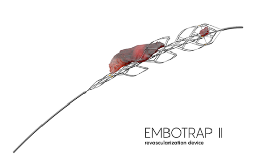 Cerenovus launches largest global registry to study stroke-inducing ...