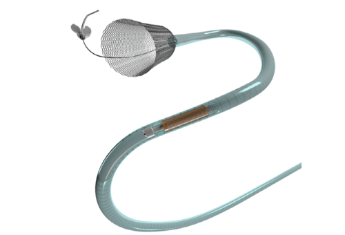 FDA approval on expanded indication for Pipeline Flex embolisation device