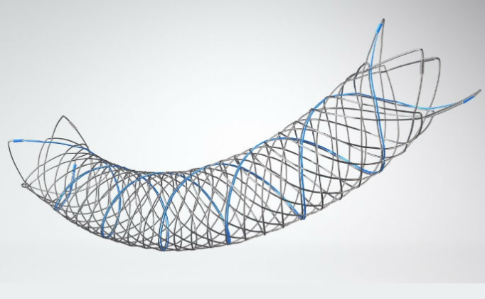 Type of stent denotes degree of complete occlusion following stent ...