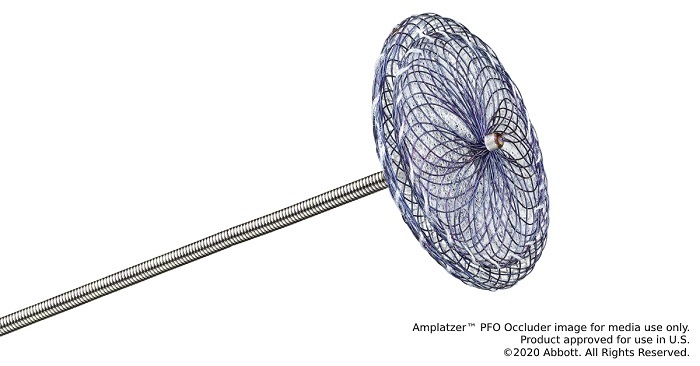 Amplatzer-PFO-Occluder_2.jpg - NeuroNews International