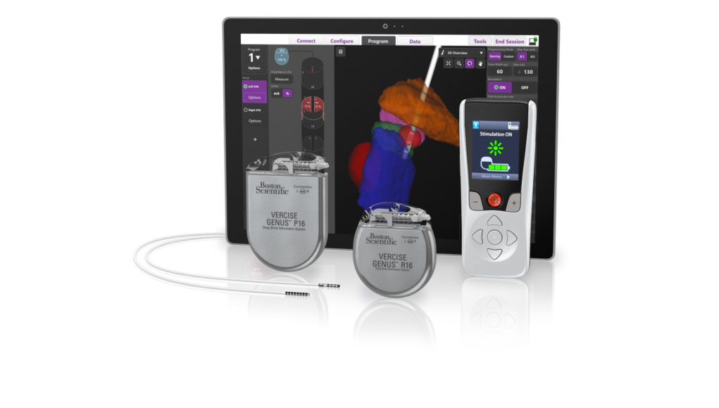Vercise Genus DBS system received FDA approval - NeuroNews International
