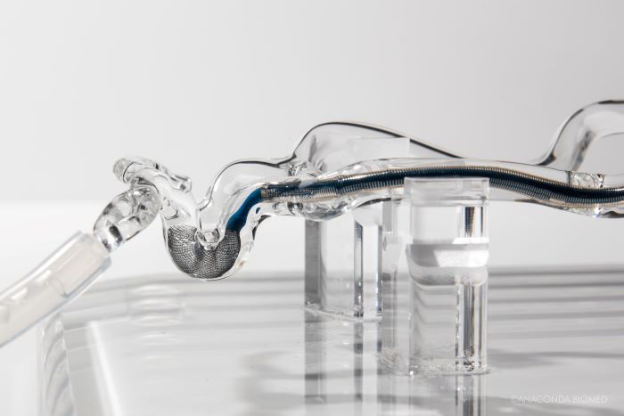 New study supports Anaconda Biomed’s ANA catheter system for ischaemic ...