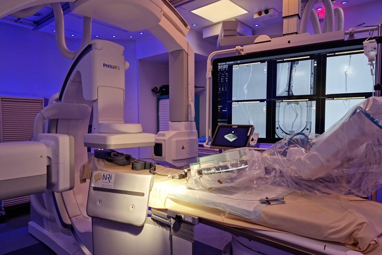 Robocath, Rennes UH to research stroke treatments with Philips France