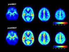 Codman Neuro launches Enterprise 2 in the USA - NeuroNews International