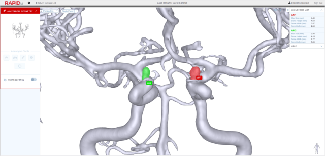 Pushing the boundaries of cerebral aneurysm detection, monitoring and ...