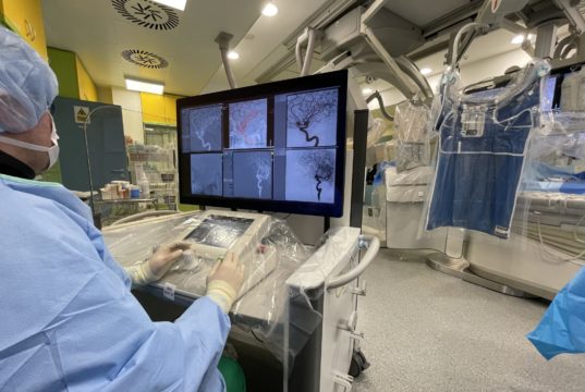 The inevitable growth of neurovascular robotics: Improved precision ...