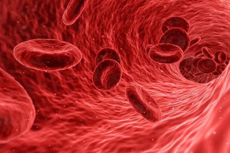 Fluid dynamics modelling elucidates role of blood flow impairment in ...