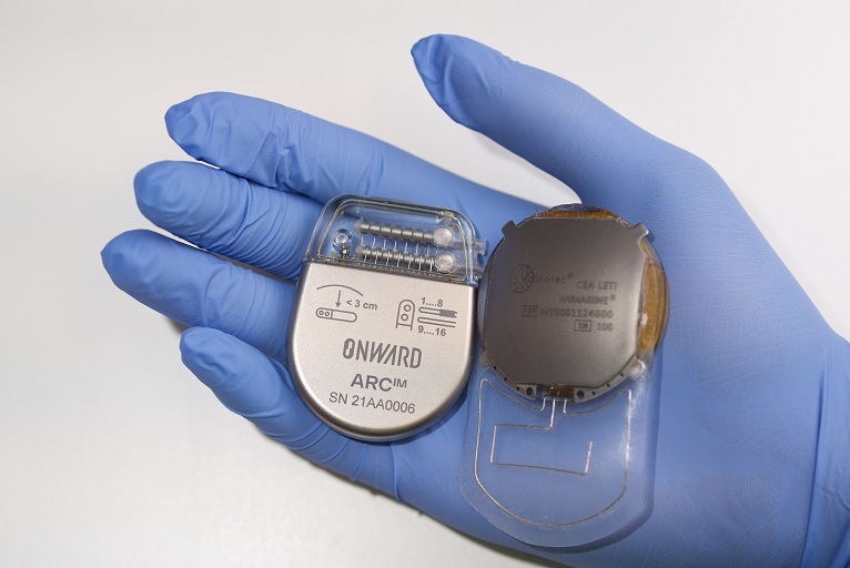 Onward announces first-in-human implant of ARC-IM stimulator with ...