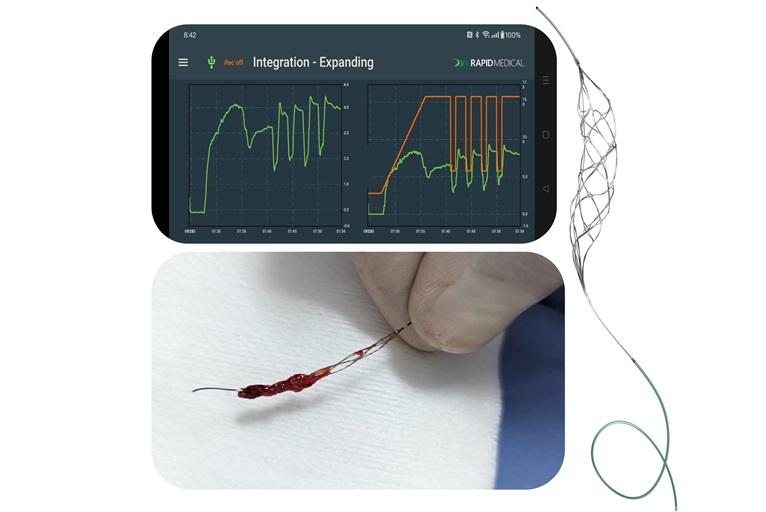 Rapid Medical completes successful stroke procedures with “world’s ...