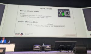 Fresh DISTAL and ESCAPE-MeVO analyses further elucidate stroke ...