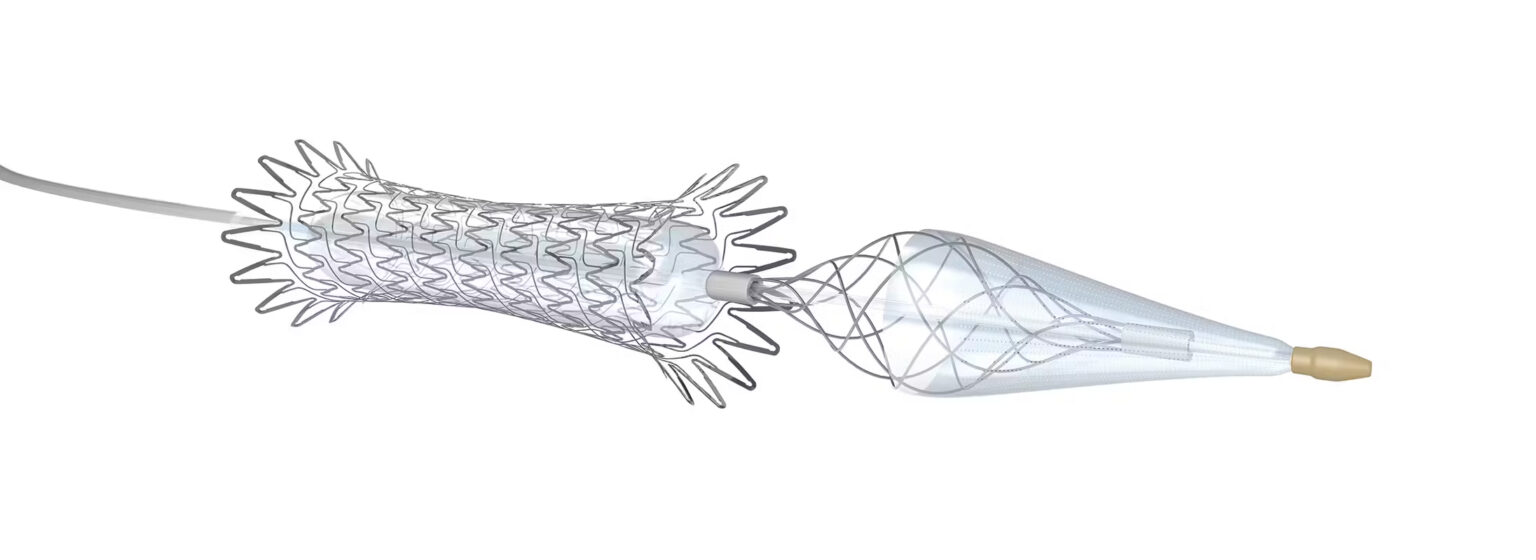 Medtronic fully launches Neuroguard IEP system