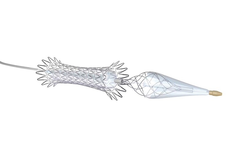 Medtronic fully launches Neuroguard IEP system