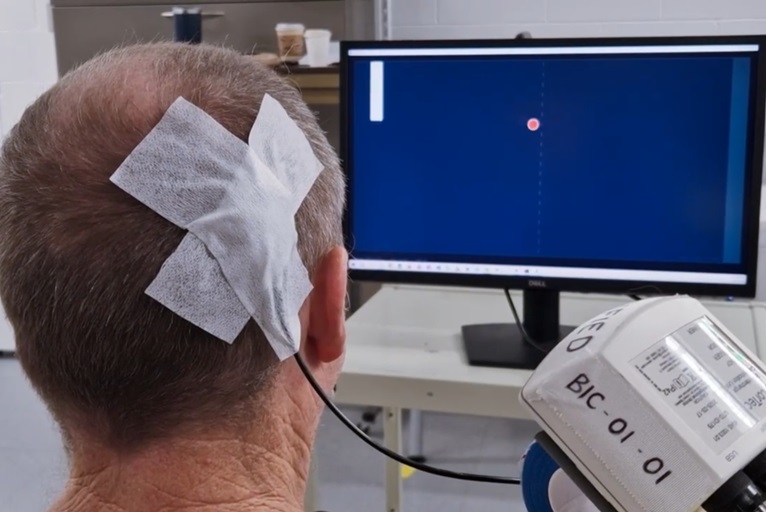 CorTec's Brain Interchange BCI system enables stroke patient to control ...